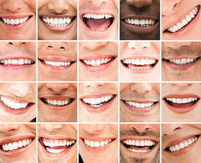 Simply Smile Dental , Dentist Glendale NY, Dentist Queens NY